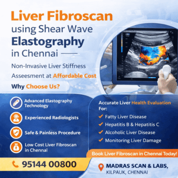 Liver FibroScan in Chennai | Non-Invasive Liver Scan